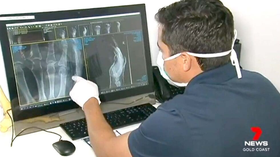 Fracture Clinic Services