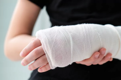Broken Wrist & Wrist Fracture Treatments | Gold Coast & Brisbane