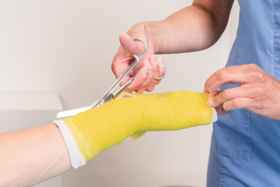 After Cast Removal - what to do after fracture cast removal