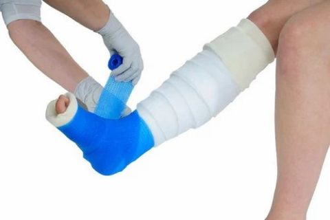 Is you cast waterproof? Fracture cast types, features, benefits
